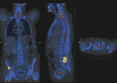 Laborator Clinic de Medicină Nucleară – Institutul Oncologic Prof. Dr ...